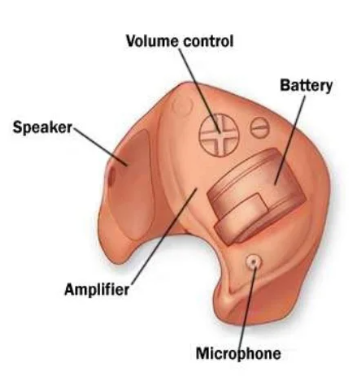How Hearing Aids Work
