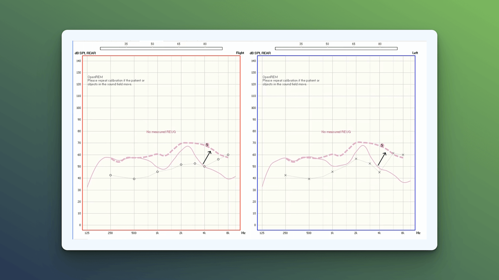 Buy the Sony CRE-C10 OTC Hearing Aid