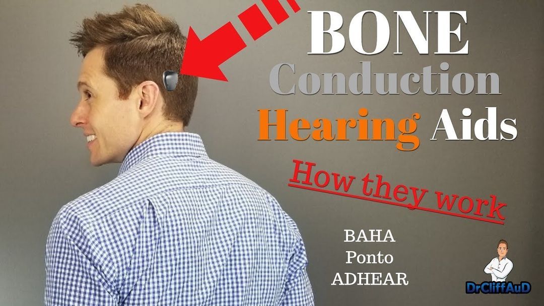 How Bone Conduction Hearing Aids Work | Cochlear BAHA, Oticon Medical ...