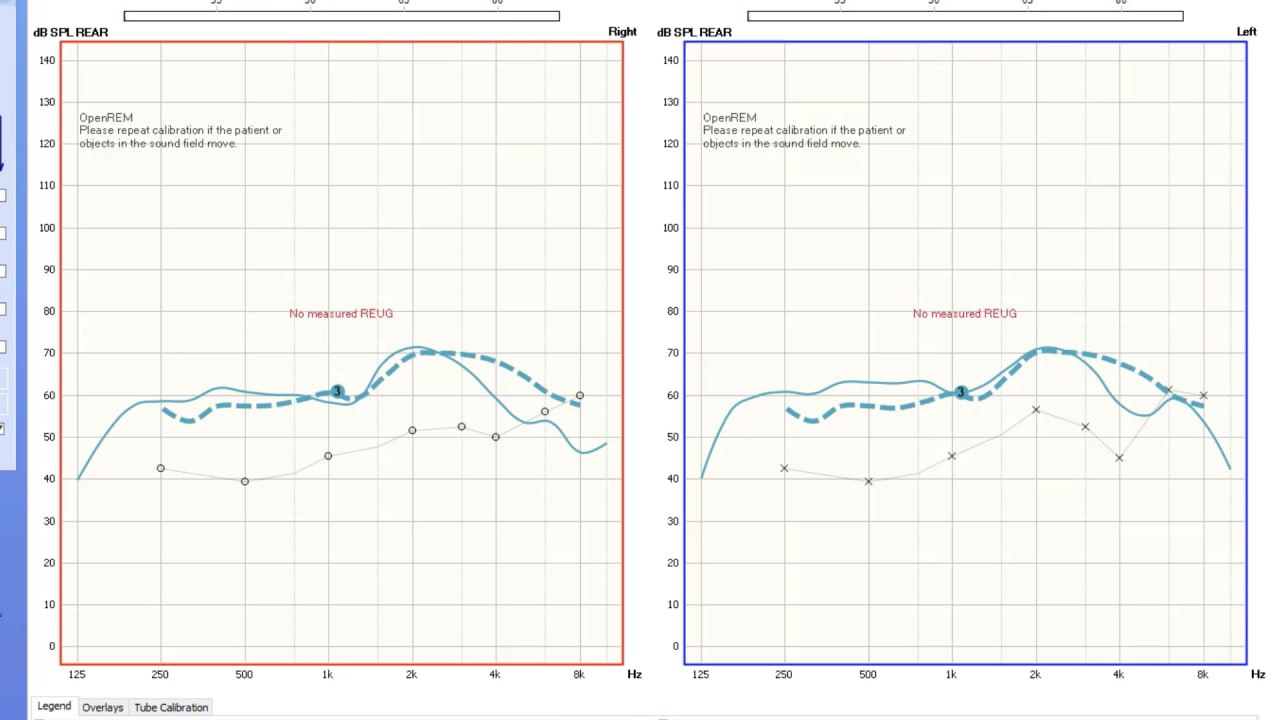 AirPods Pro 2 as Hearing Aids? An Audiologist's Review