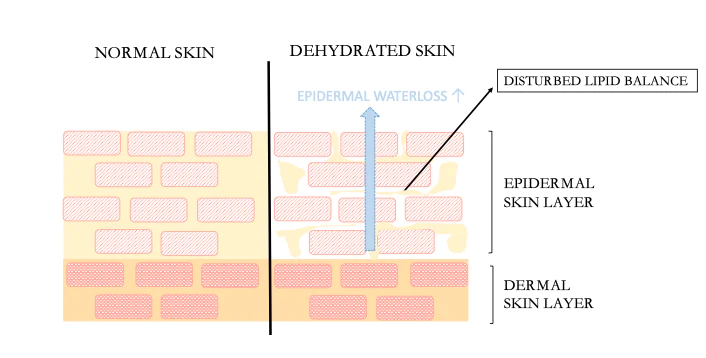 How to Hydrate Skin: The Ultimate Guide - Clinique Main D’or