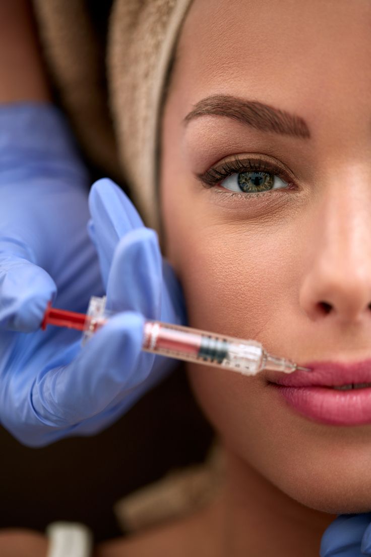 Botox Lip Flip for Natural-Looking Fuller Lips | Clinique Main d'Or