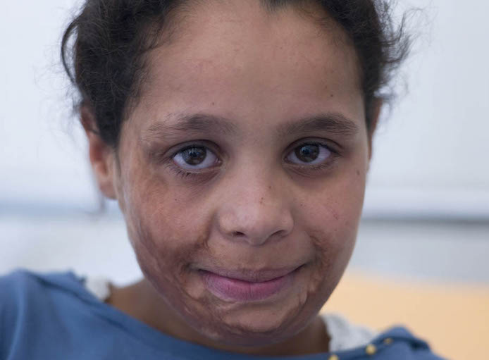 Morocco 2008 mission - Operation International