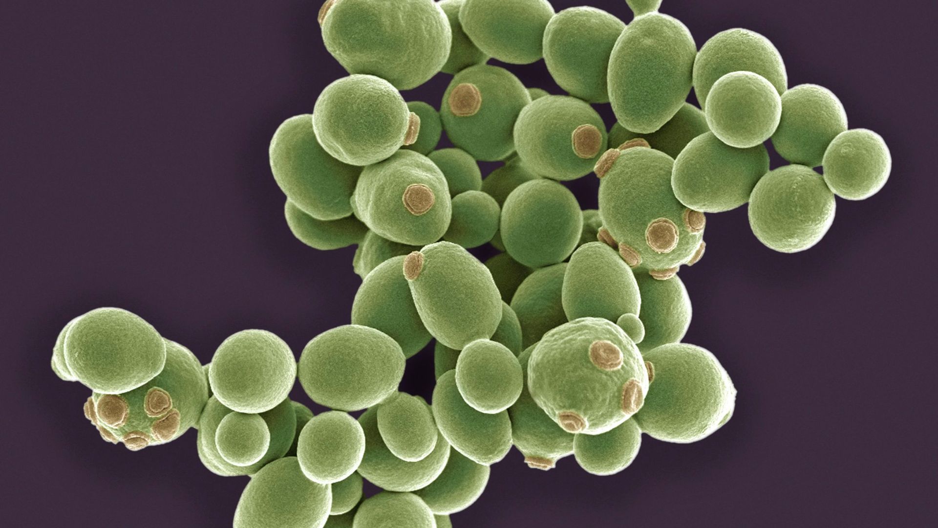 It’s Alive! Yeast Strain Thrives With Over 50% Synthetic Genome ...