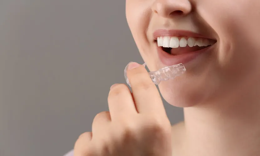 Night Guards | Central Family Dentistry