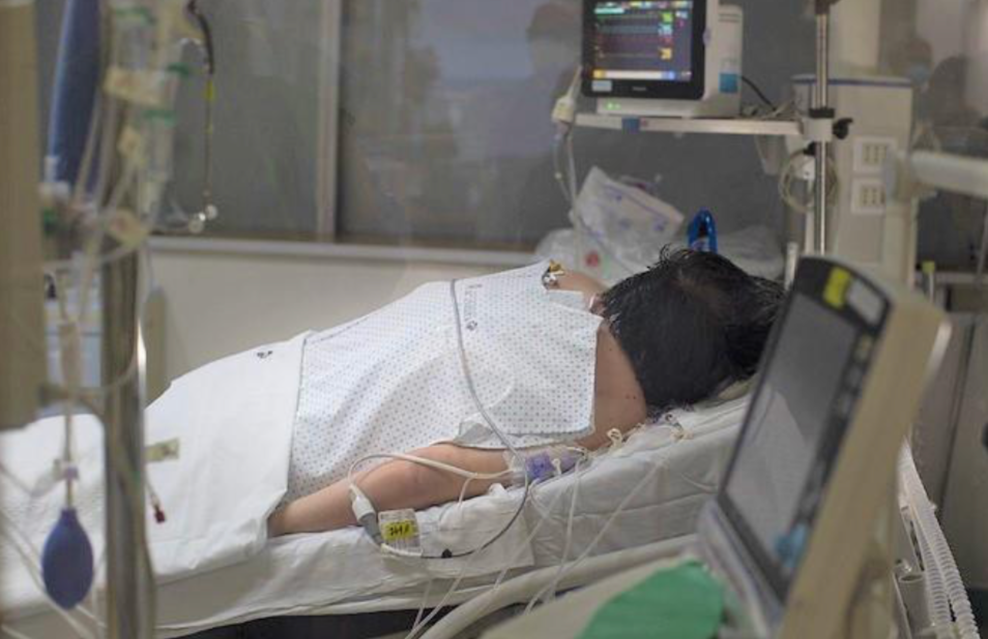 Preventing Prone Position Pressure Injuries - Tara Haelle - Mar 17, 2022