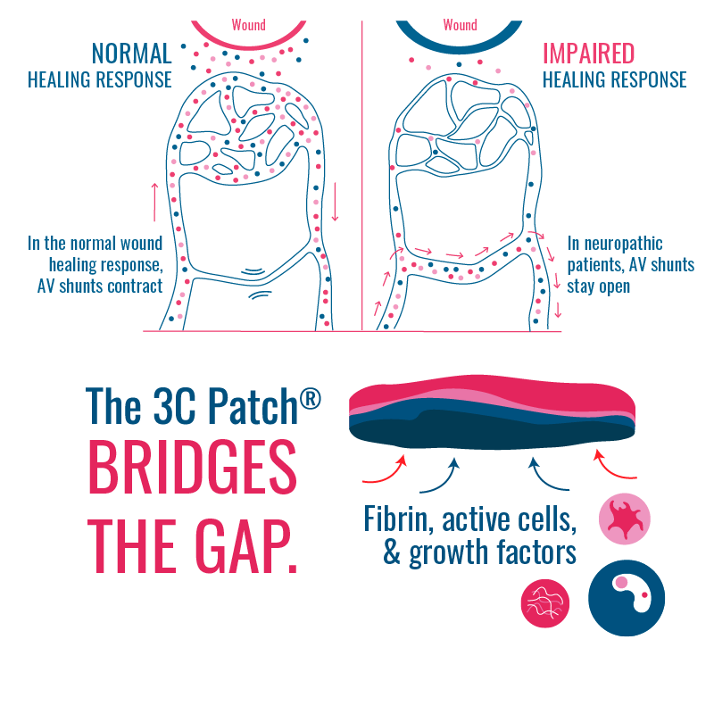 Home 3C Patch by Reapplix