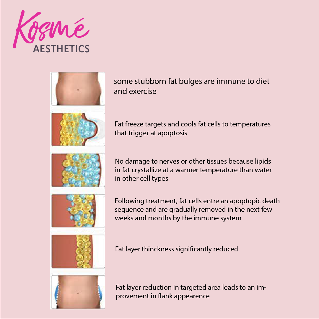 Fat Freezing Aftercare: Do's and Don'ts