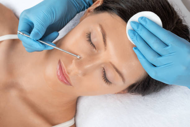 Best Extraction Facial in Singapore: Radiant Skin [2024]