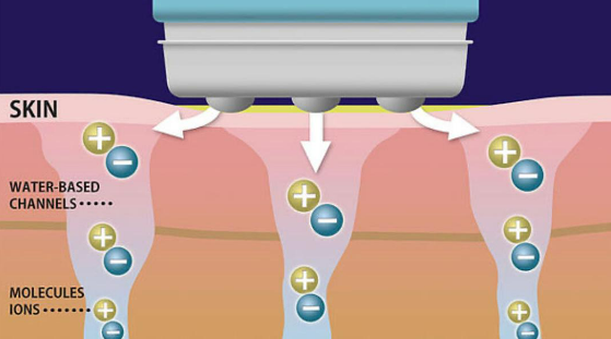 Needleless Rejuran: Anti-Wrinkle Treatment Guide Without Downtime