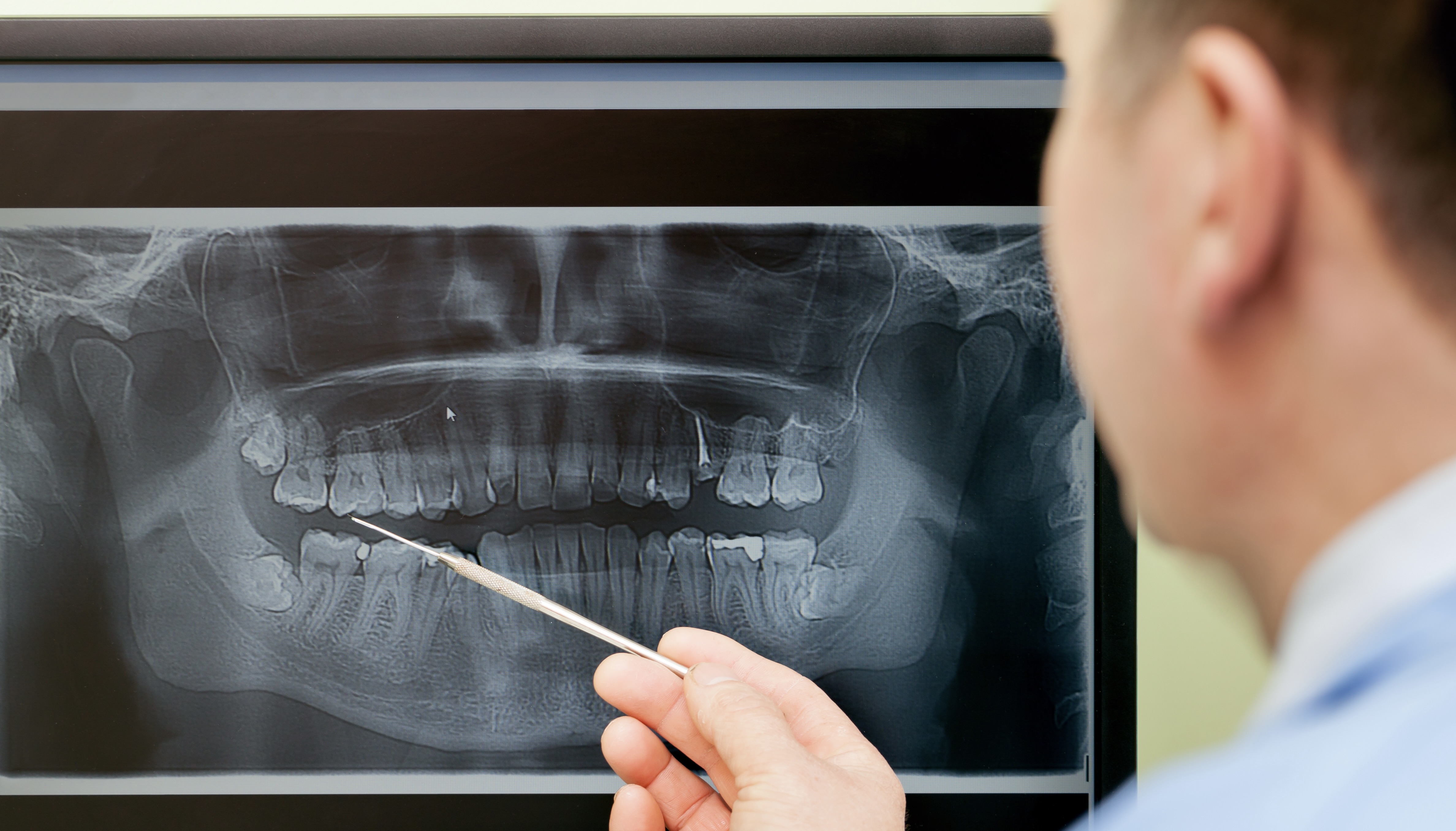 Artificial Intelligence Will Change Dentistry: What to Expect