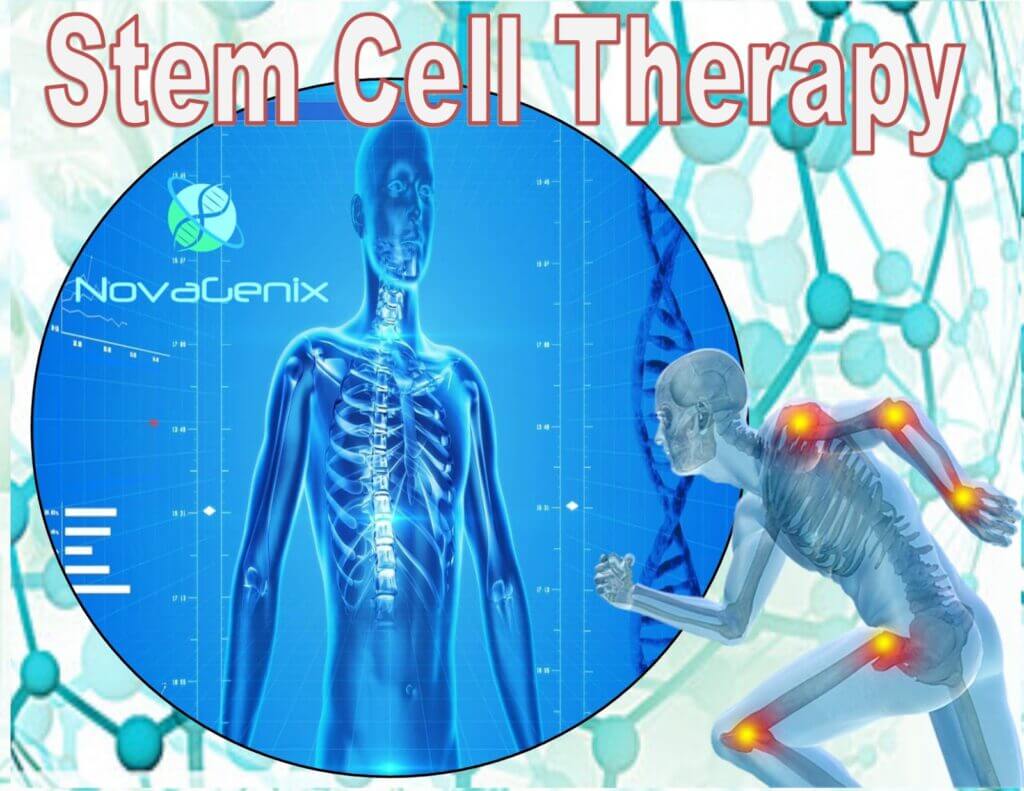 Where Can I Find The Best Stem Cell Therapy Clinic Near ME? - NovaGenix