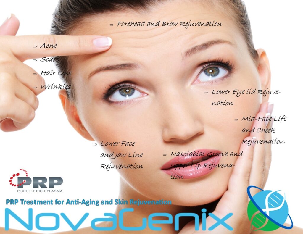 Platelet-rich Plasma For Skin Rejuvenation & Anti-Aging - NovaGenix