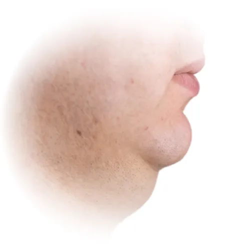 Aesthetic Clinic Singapore | The Artisan Clinic