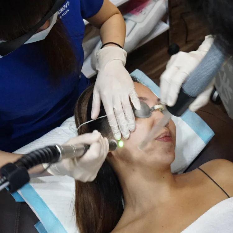 Cynosure Elite IQ™ 5D Laser Lifting