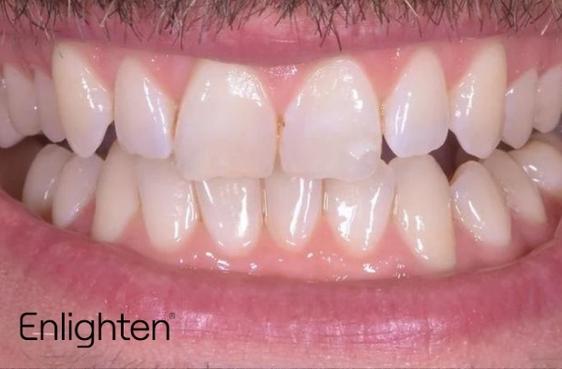 Book an appointment | Best general and cosmetic dentist in Falmouth ...