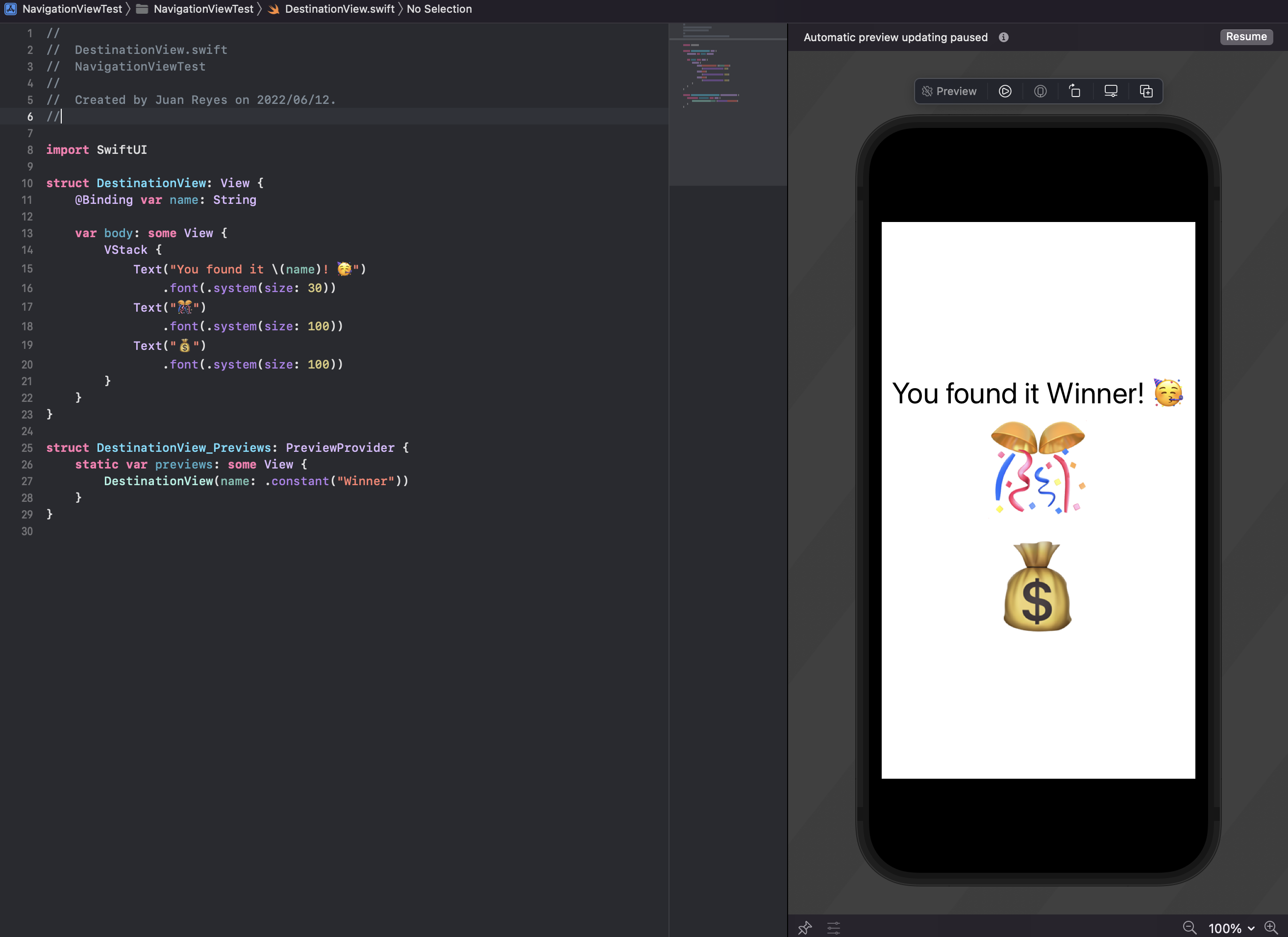 SwiftUI NavigationView: Learn By Example | Waldo Blog