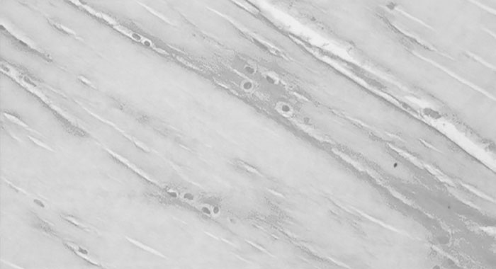 Fascia Insights: Being Precise about Fascia with Dr. Carla Stecco | SFI ...