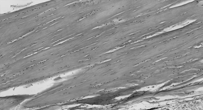 Fascia Insights: Being Precise about Fascia with Dr. Carla Stecco | SFI ...