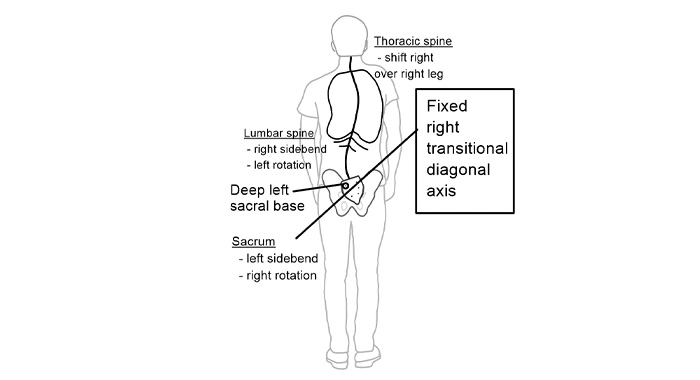 The Mysteries of the Sacrum Revealed | SFI Journal