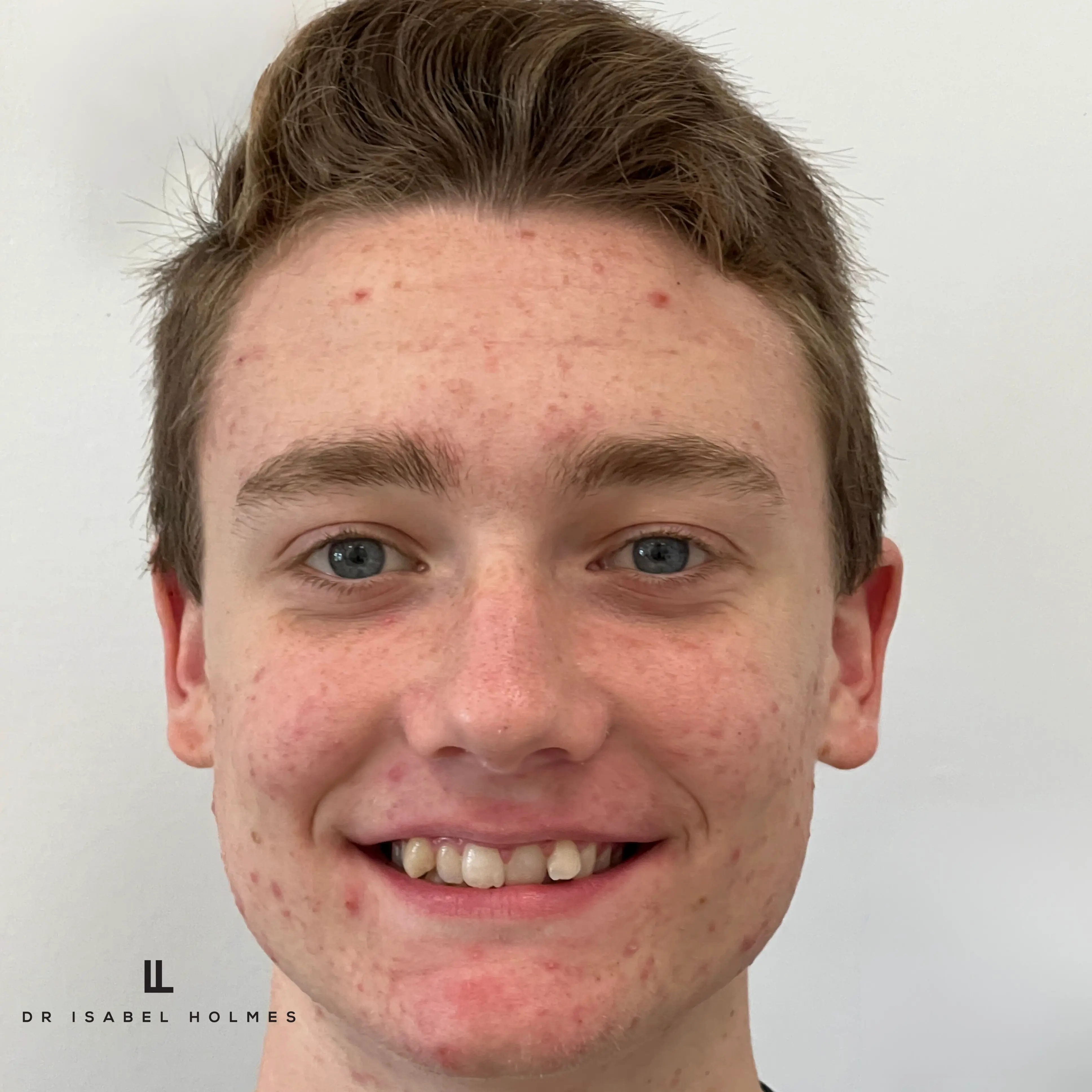 Invisalign Mount Gambier - Illumident