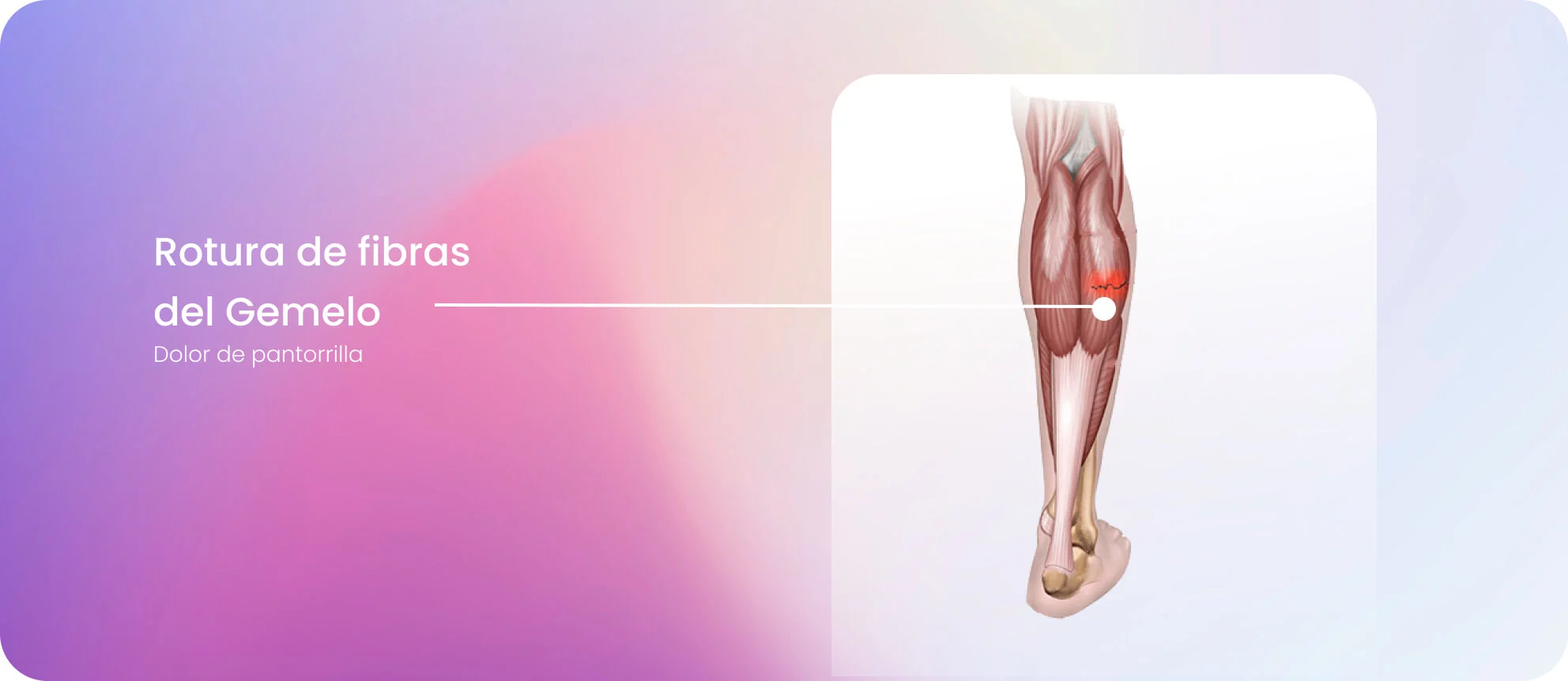 Sobrecarga muscular del Gemelo