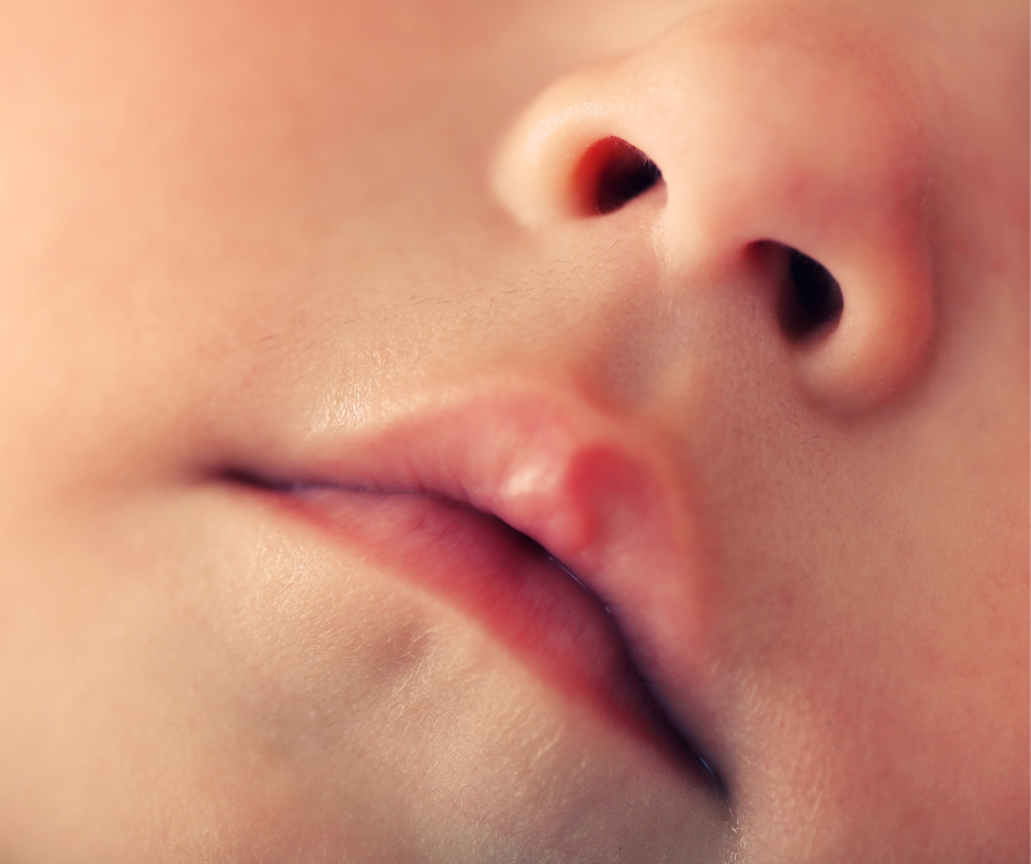 Bloom Medical | Resources