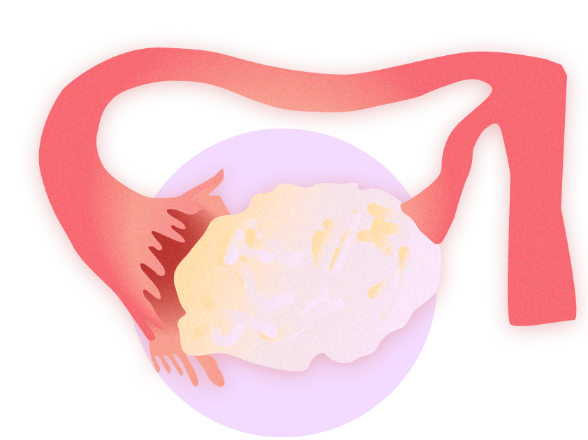 Amilis - Compare Top Egg Freezing Clinics