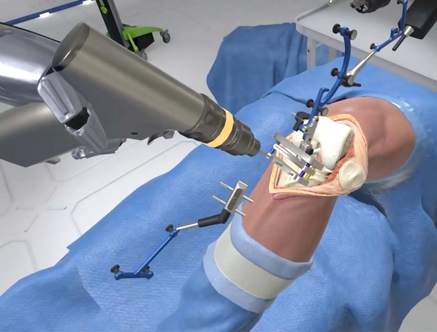 VR Surgery Simulator Ghost Medical VR Surgery Simulator Ghost Medical