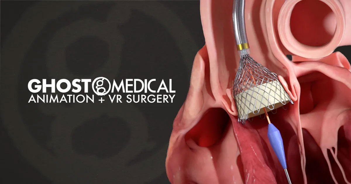 Ghost Medical Animation + VR Surgery