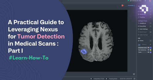 Datature | The Complete AI Vision Platform