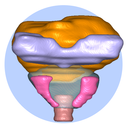 Innersightlabs | Interactive 3D model for pre-operative planning and ...