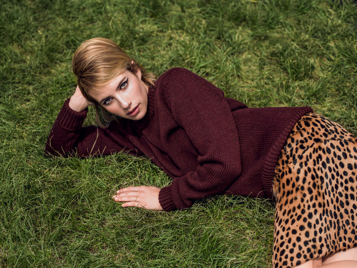 Emma Roberts Bruises
