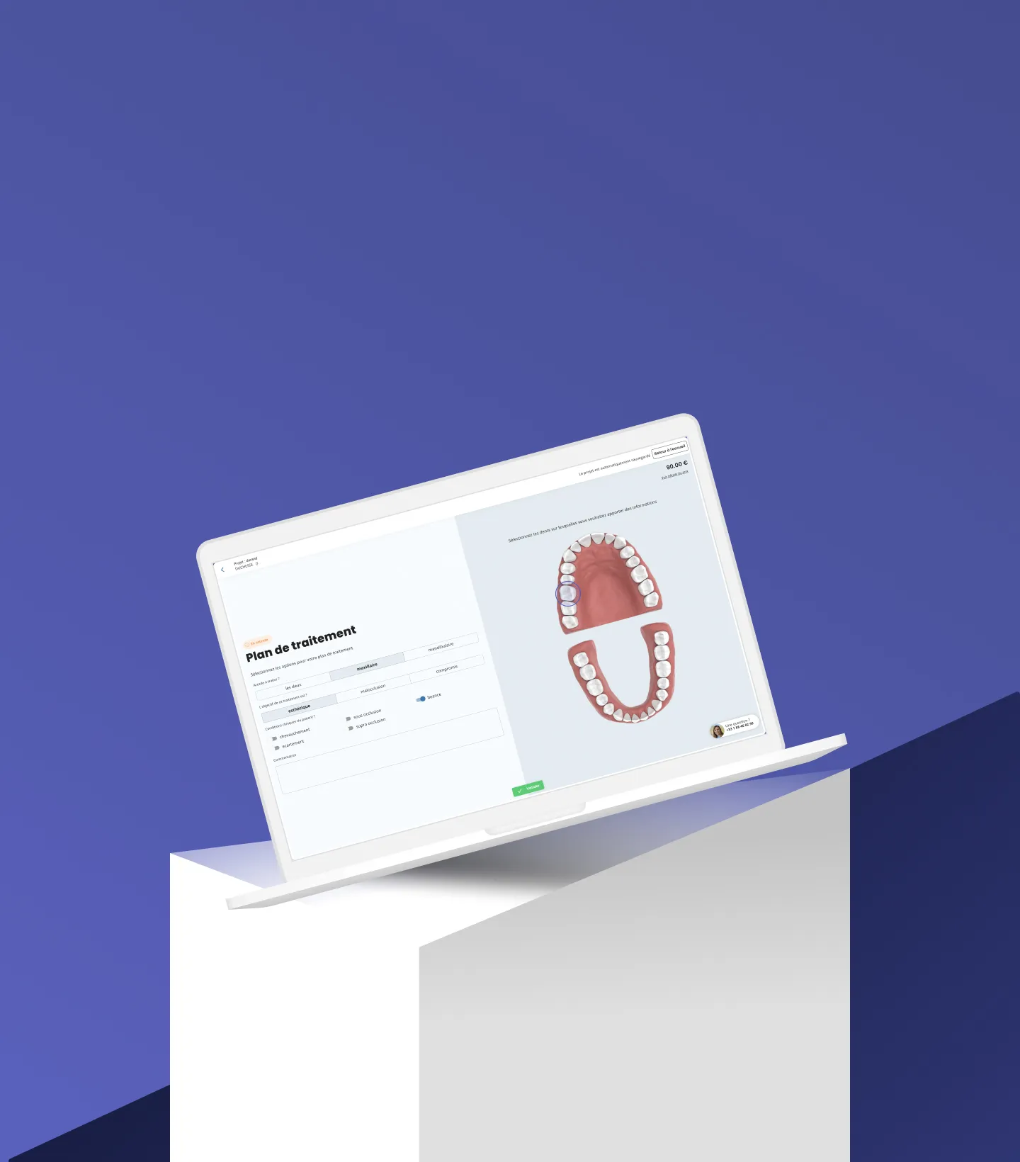 3Dcelo | Guide Chirurgical