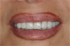 Amazing Smile Transformations: Before and After Photos