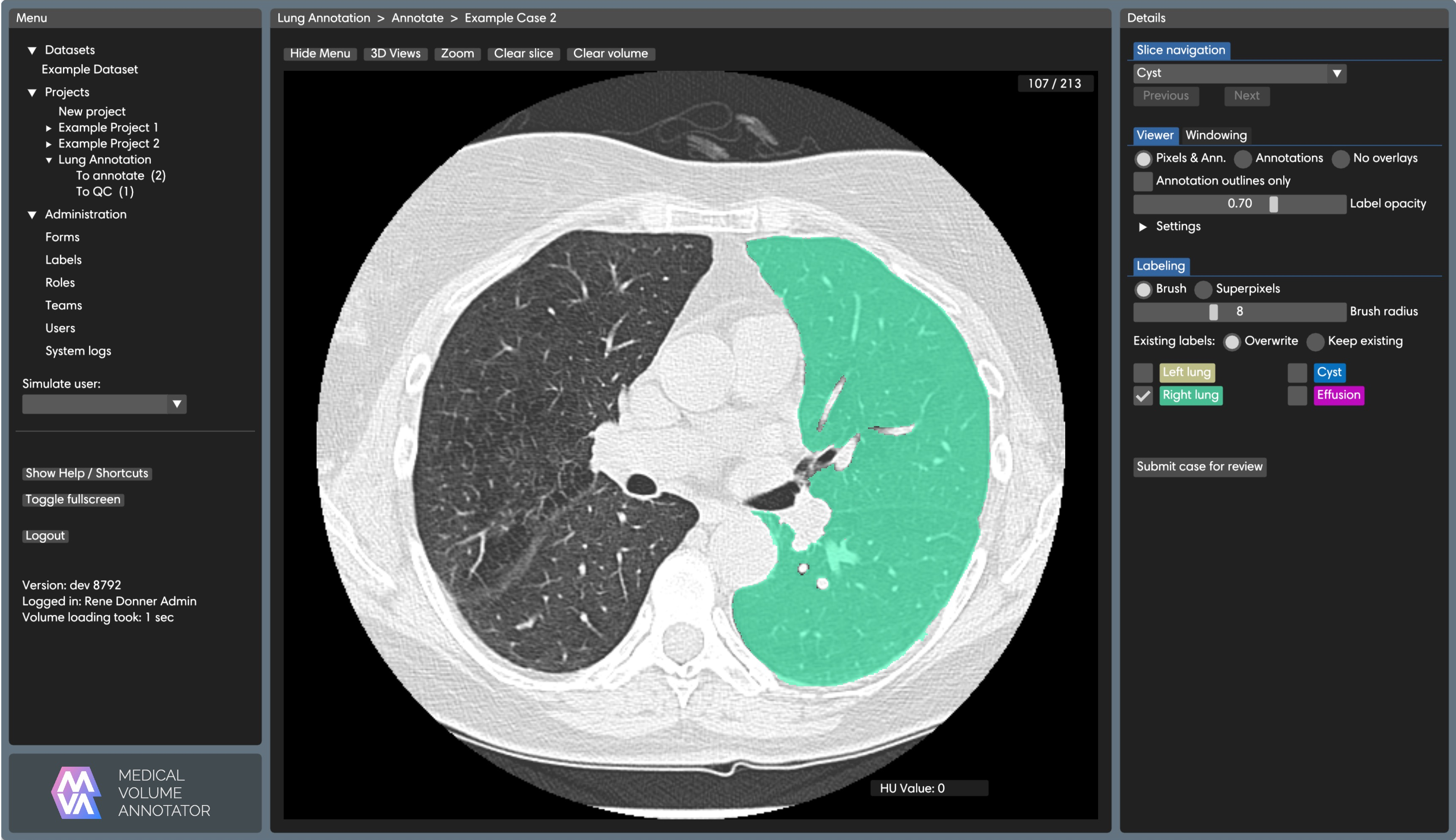 MVA.ai Medical Volume Annotator