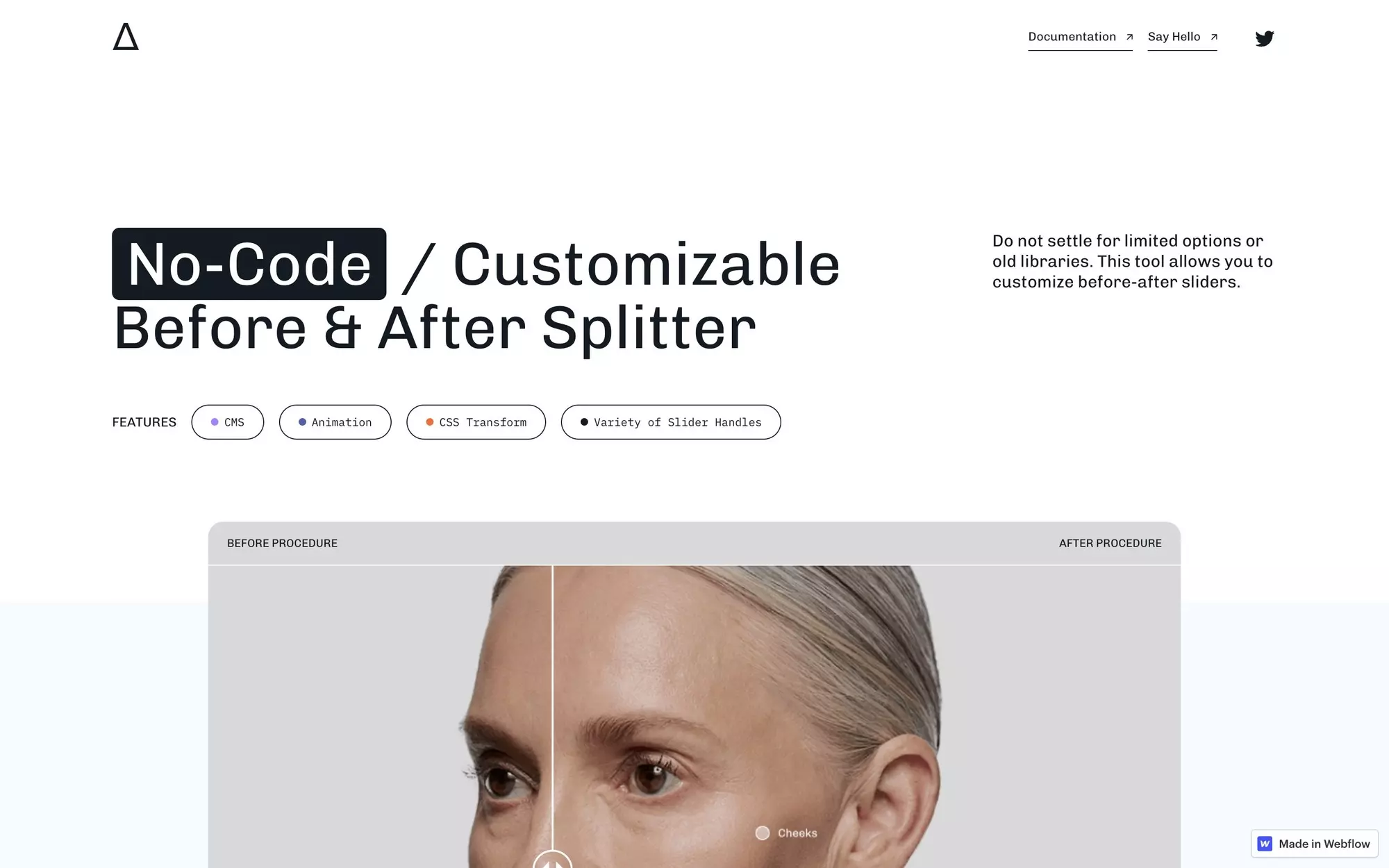 Before/After Splitter [Component] No-Code Supply Co.