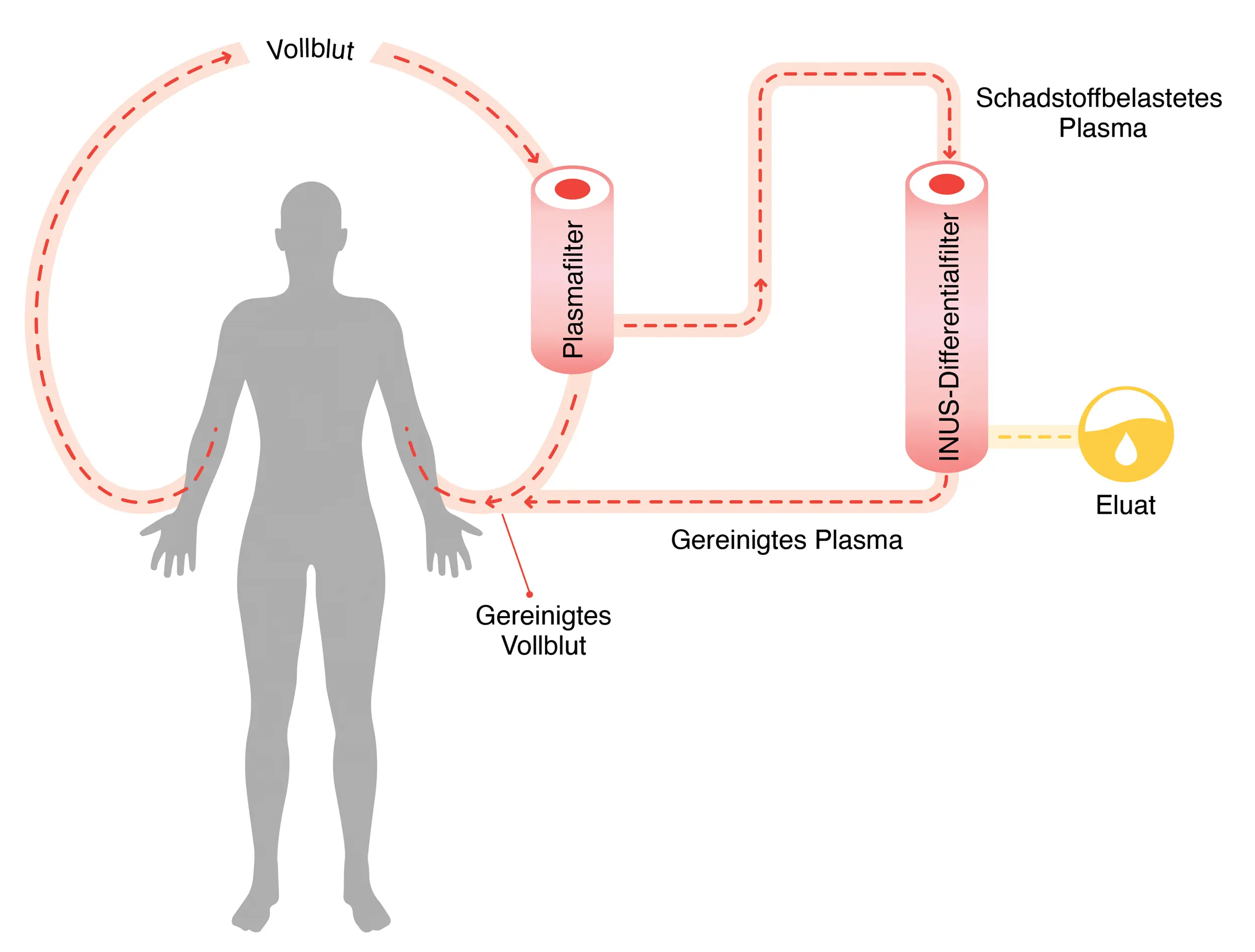 Relieving environmental toxins, Dr. Philip Mavberg | INUSpheresis ...