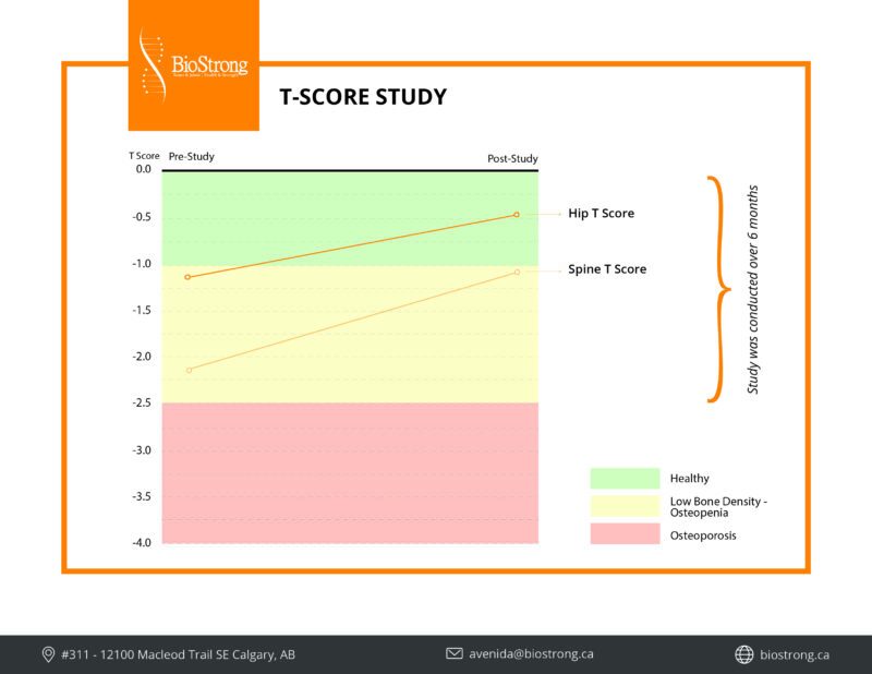 Biodensity: Bone Density Treatment in Calgary | BioStrong