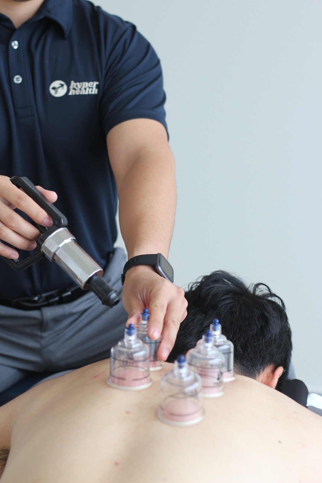 What is Cupping Therapy | Hyperhealth