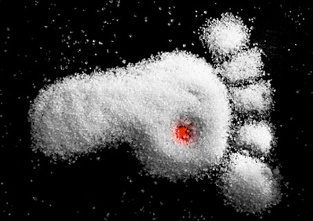 Crucial Things to Know About Diabetes and Foot Problems | Hyperhealth