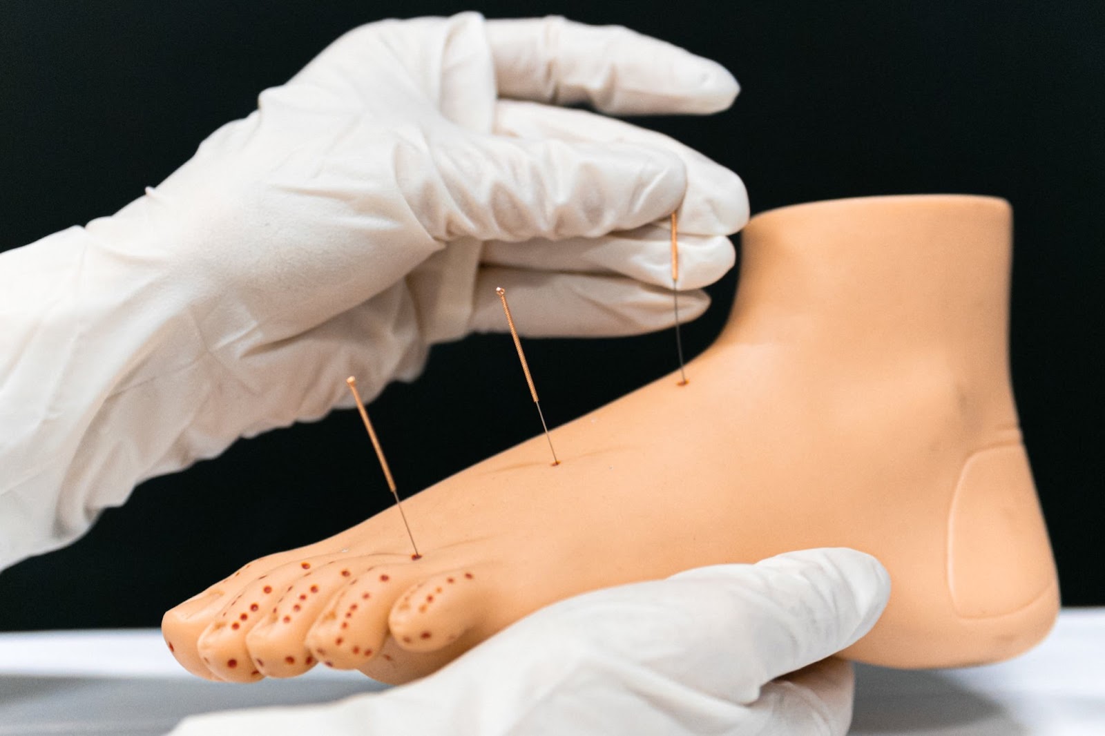 Understanding Pins and Needles on the Back | Hyperhealth