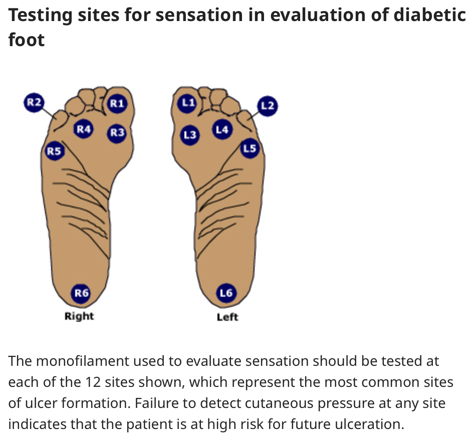 The Role of a Foot Specialist in Diabetic Care | Hyperhealth