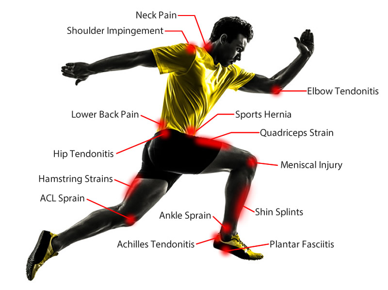 Understanding Sports Injury and Its Rehabilitation Process | Hyperhealth
