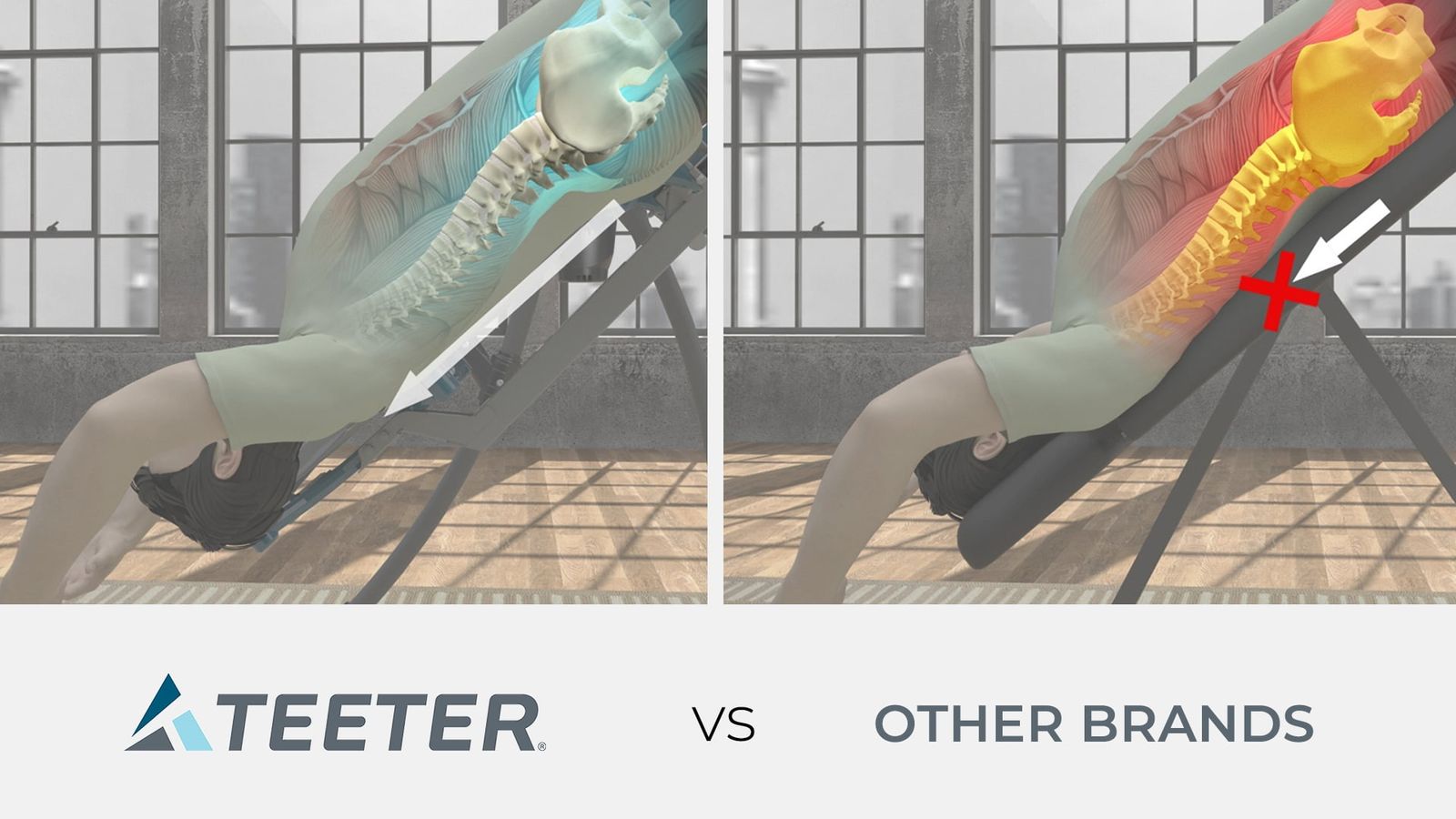 Inversion Tables | FitSpine on TV | Teeter Australia