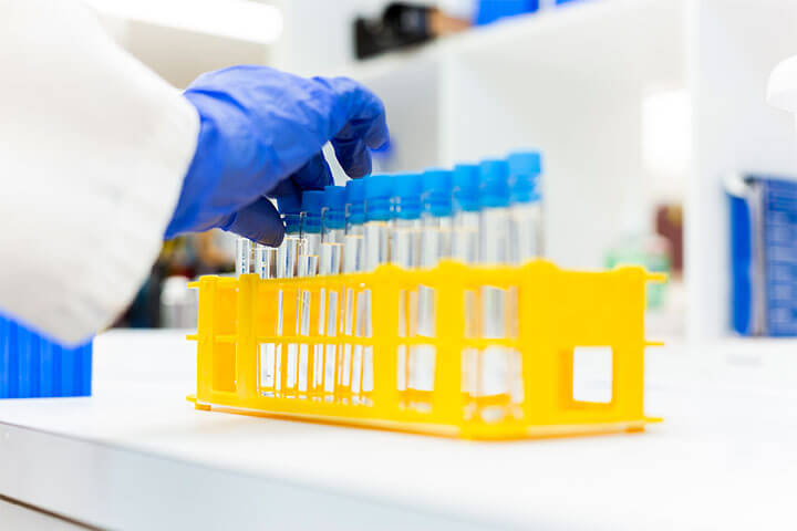 Lab Testing | ACS Laboratory