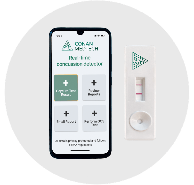 Conan MedTech - Concussion Detection