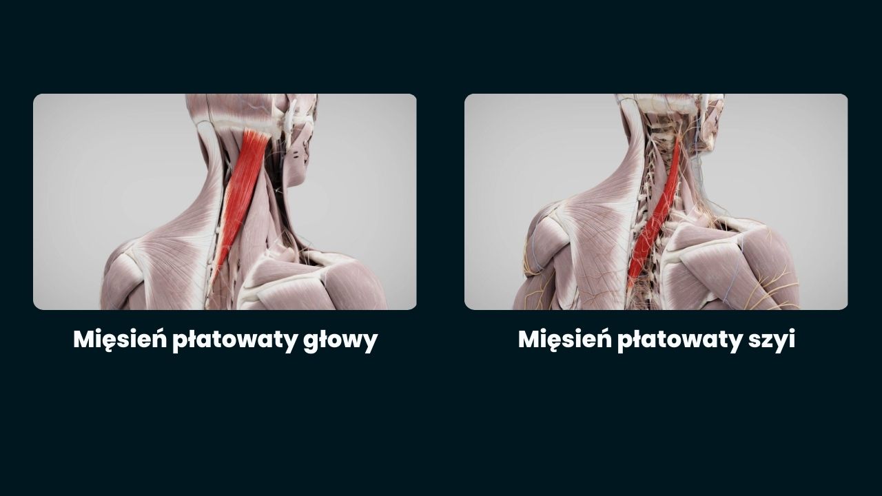 Ból z tyłu głowy - mięsień płatowaty głowy i szyi, ćwiczenia, funkcje i budowa