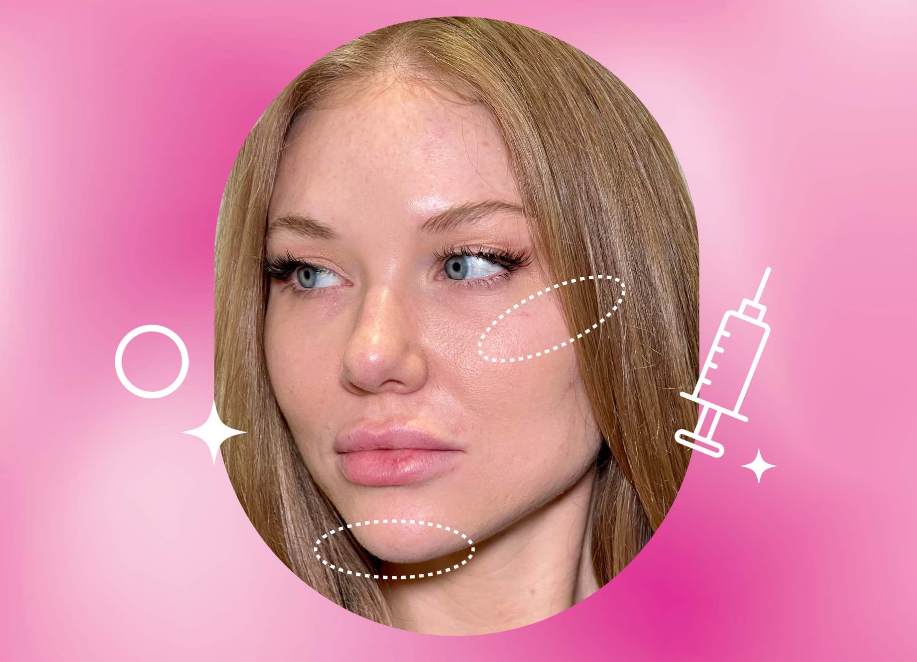 Upkeep | What's Facial Balancing?