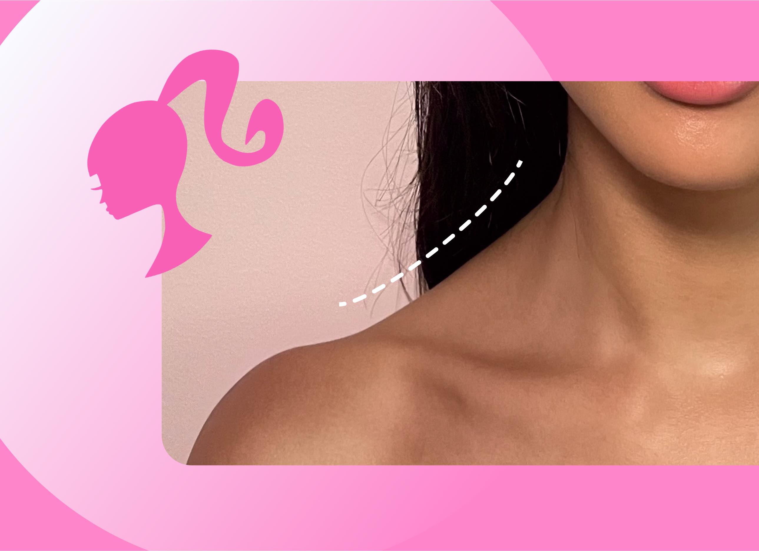 Upkeep | How Long Does Barbie Botox Last?